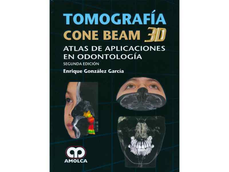 Tomografía Cone Beam 3D. Atlas de Aplicaciones en Odontología