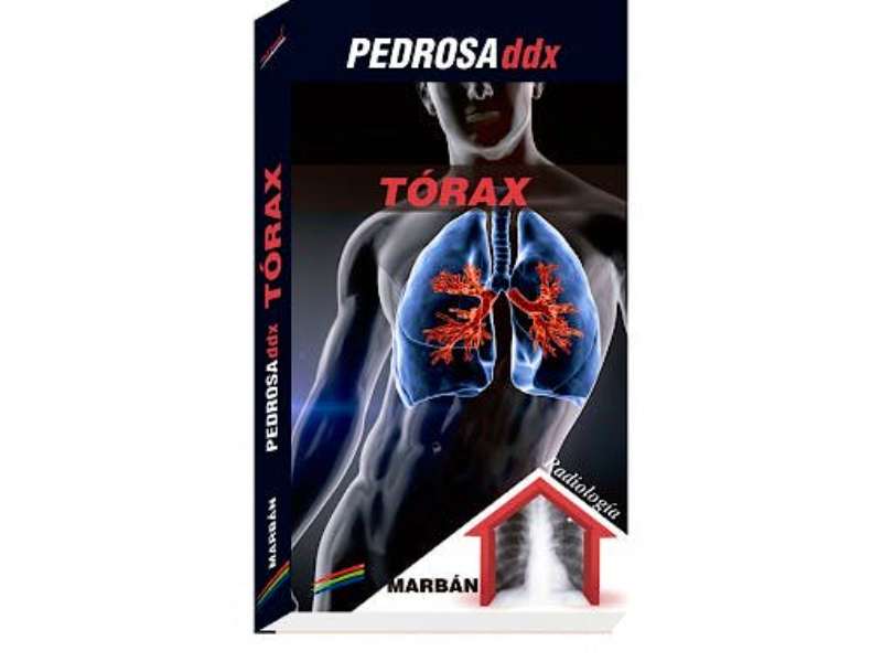 Pedrosa ddx: Tórax
