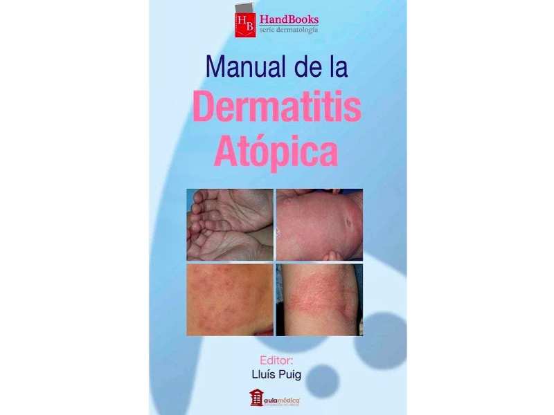 Manual de la Dermatitis Atópica