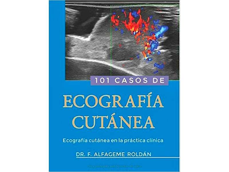 101 Casos de Ecografía Cutánea. Ecografía Cutánea en la Práctica Clínica