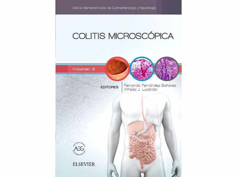 Colitis Microscopica (Clinicas Iberoamericanas de Gastroenterologia y ...