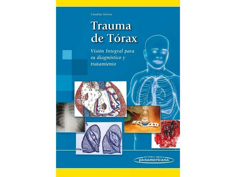 Trauma de Tórax. Visión Integral para Su Diagnóstico y Tratamiento