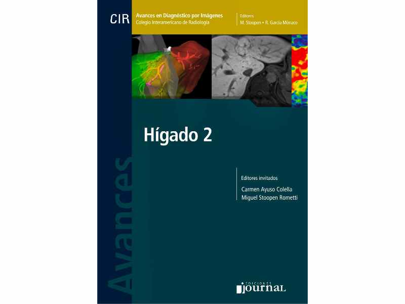 Avances en Diagnóstico por Imágenes 16: Hígado 2 (CIR, Colegio ...