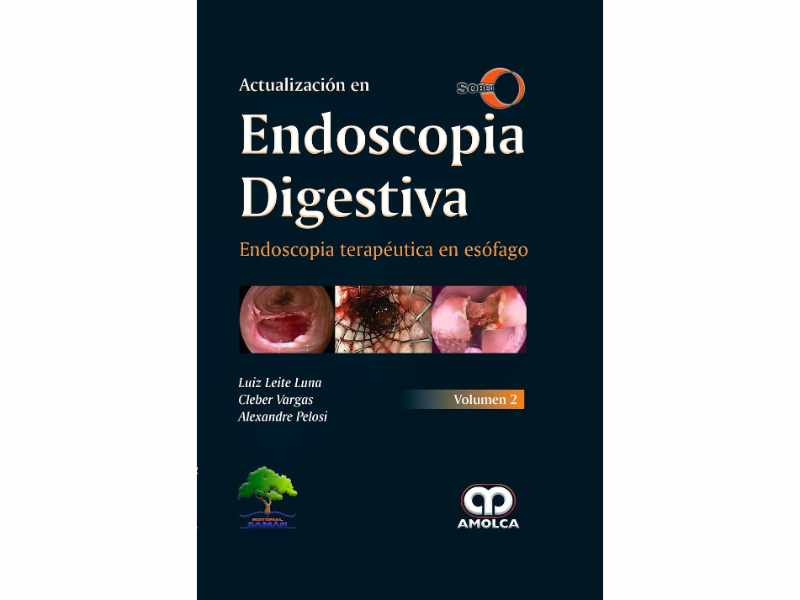 Actualización en Endoscopia Digestiva, Vol. 2: Endoscopia Terapéutica ...