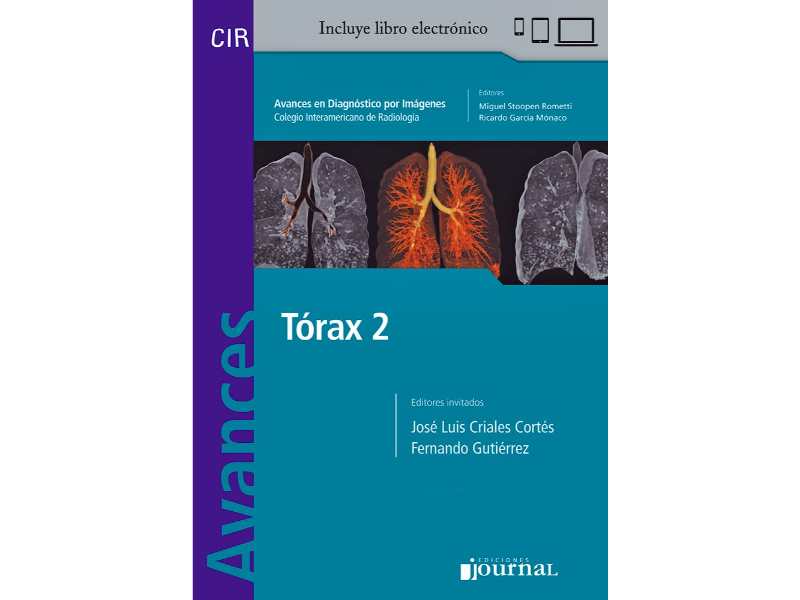 Avances en Diagnóstico por Imágenes 17: Tórax 2 (CIR, Colegio ...