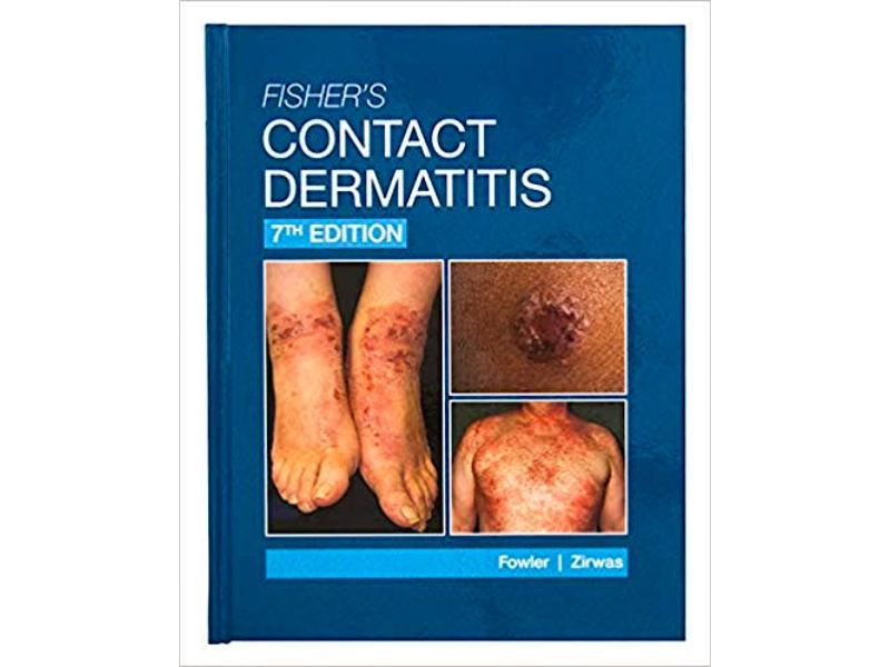 Dermatitis de Contacto Fisher's / Fisher's Contact Dermatitis