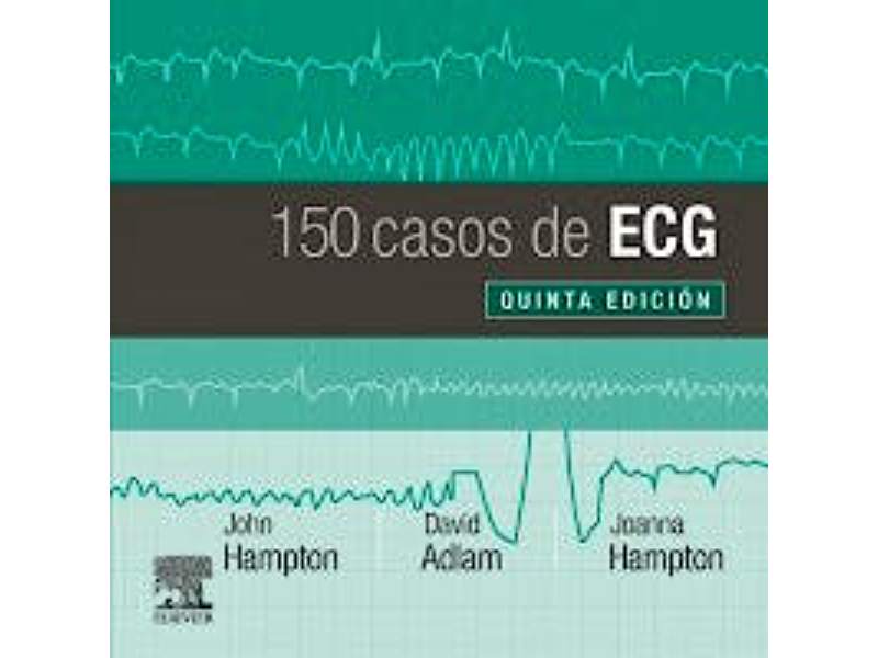 150 Casos de ECG