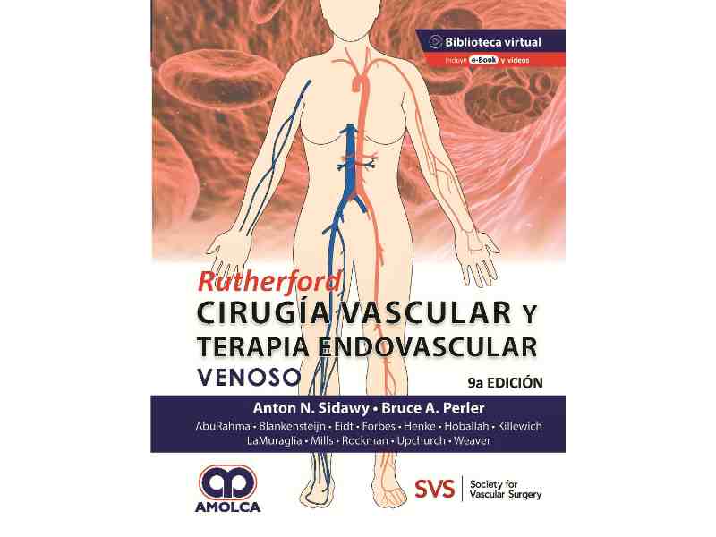 RUTHERFORD Cirugía Vascular y Terapia Endovascular: Venoso + 3 Videos