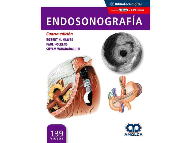 Endosonografía (Incluye 139 Videos)