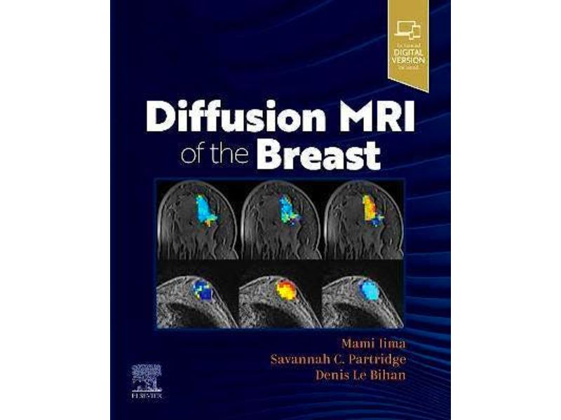 MRI de Difusión de Mama / Diffusion MRI of the Breast