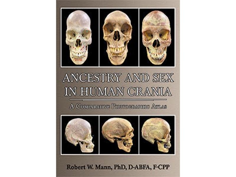 Atlas Photographique Comparatif des Crânes Humains par Ancestralité et Sexe / Ancestry And Sex ...