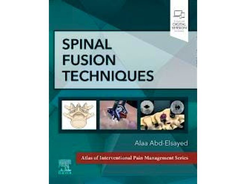 Techniques de Fusion Spinale Atlas Intervention Douleur V1 / Spinal ...