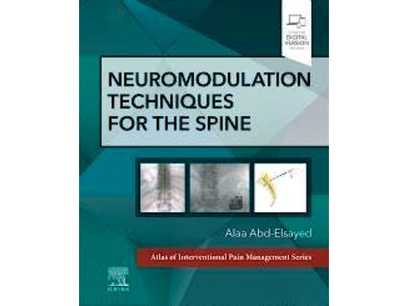 Técnicas de Neuromodulación para la Columna / Neuromodulation Techniques for the Spine