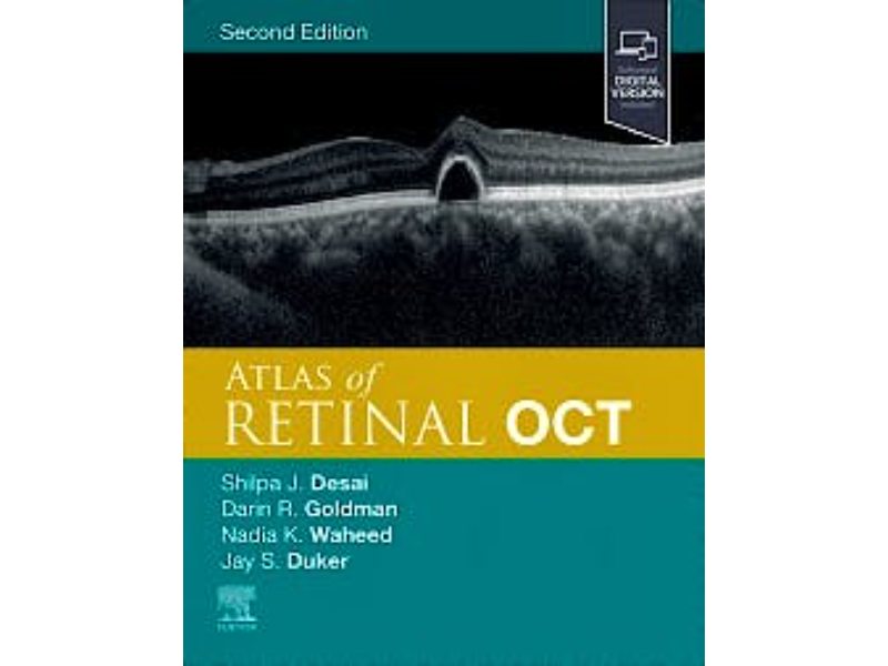 Atlas OCT Retiniano Tomografía de Coherencia Óptica / Atlas of Retinal ...