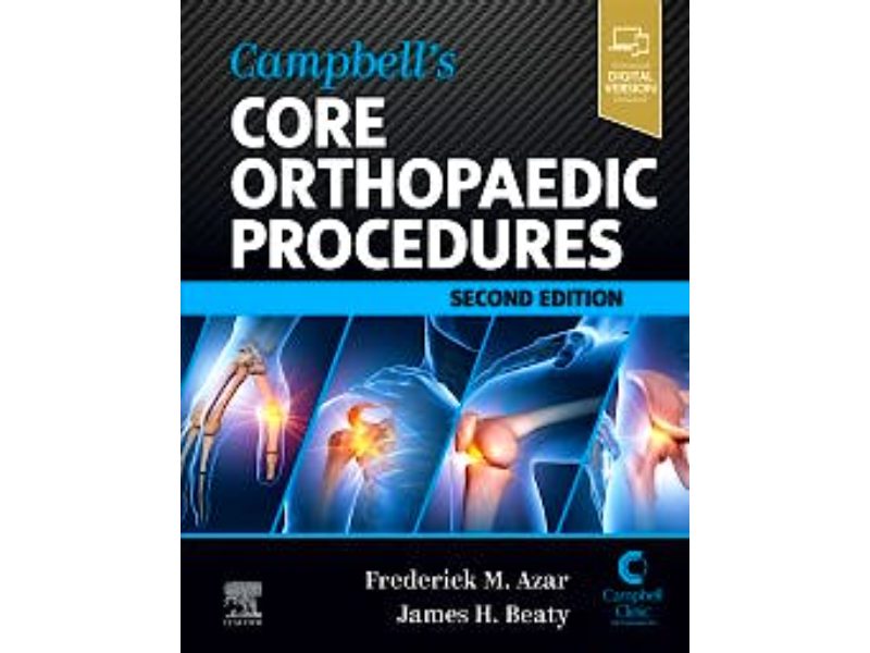 Principes de chirurgie orthopédique de Campbell / CAMPBELL's Core ...