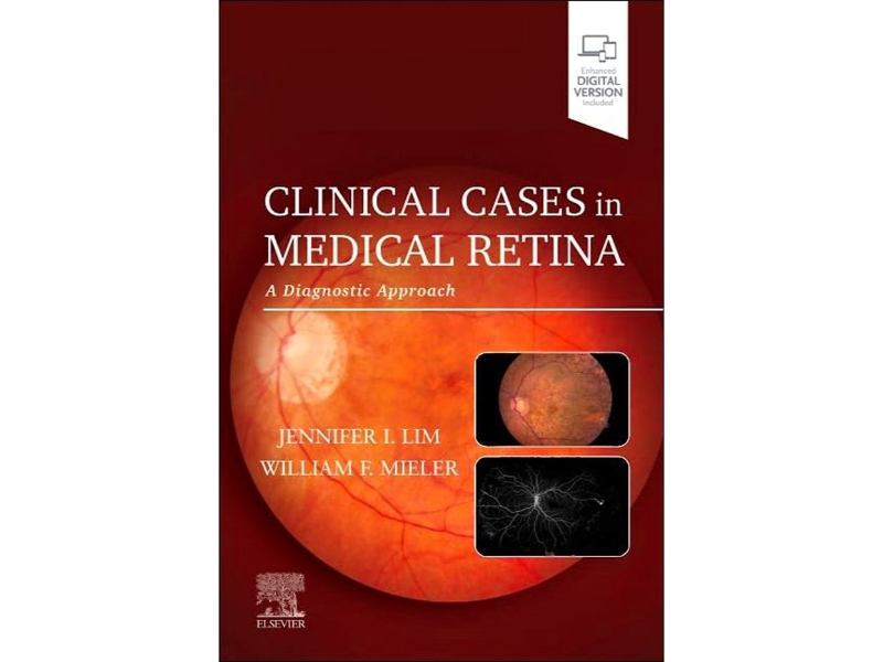 Cas cliniques en rétine médicale / Clinical Cases in Medical Retina. A ...