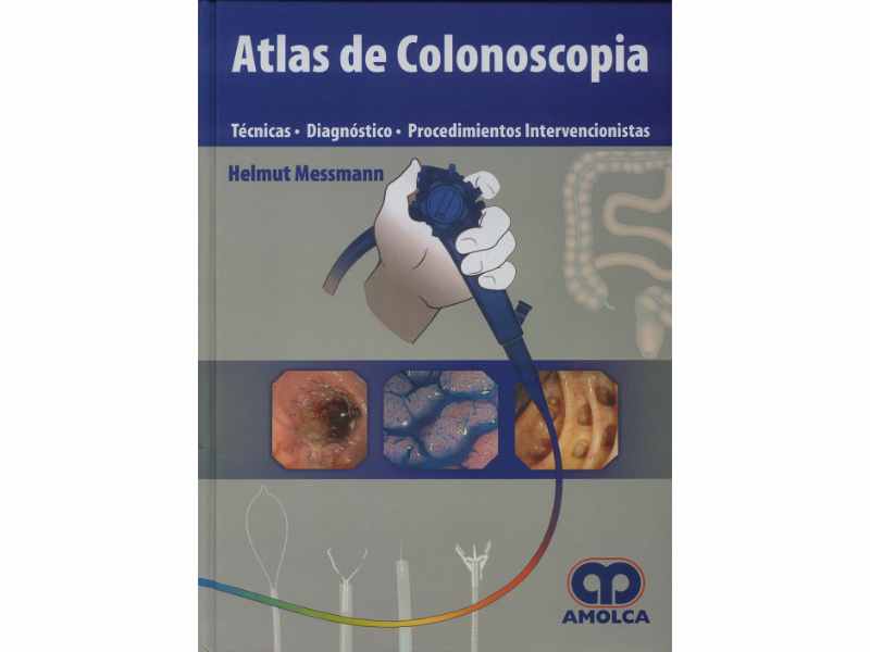 Atlas de Colonoscopia. Técnicas - Diagnóstico - Procedimientos ...