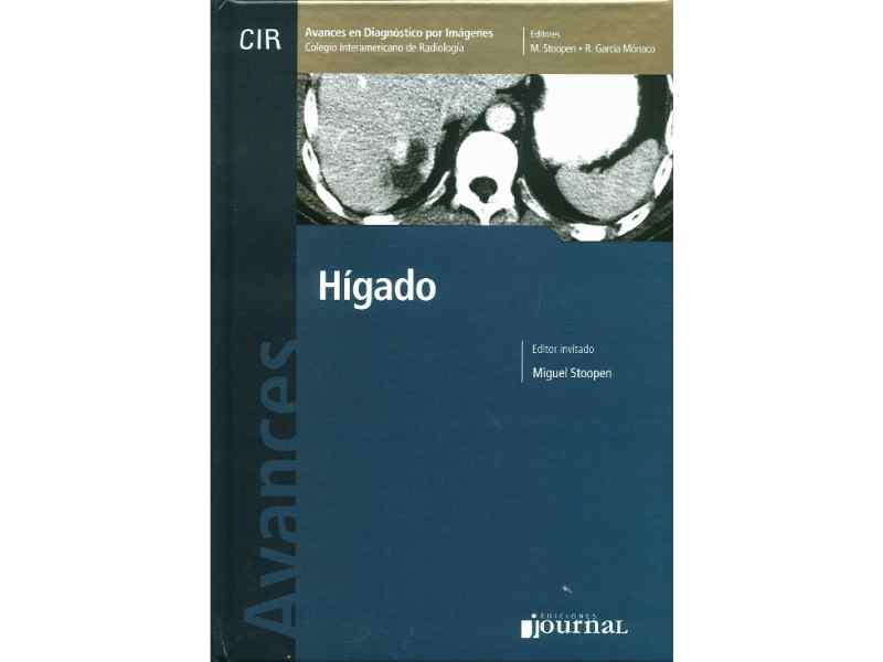 Avances en Diagnóstico por Imágenes 1: Hígado (CIR, Colegio ...