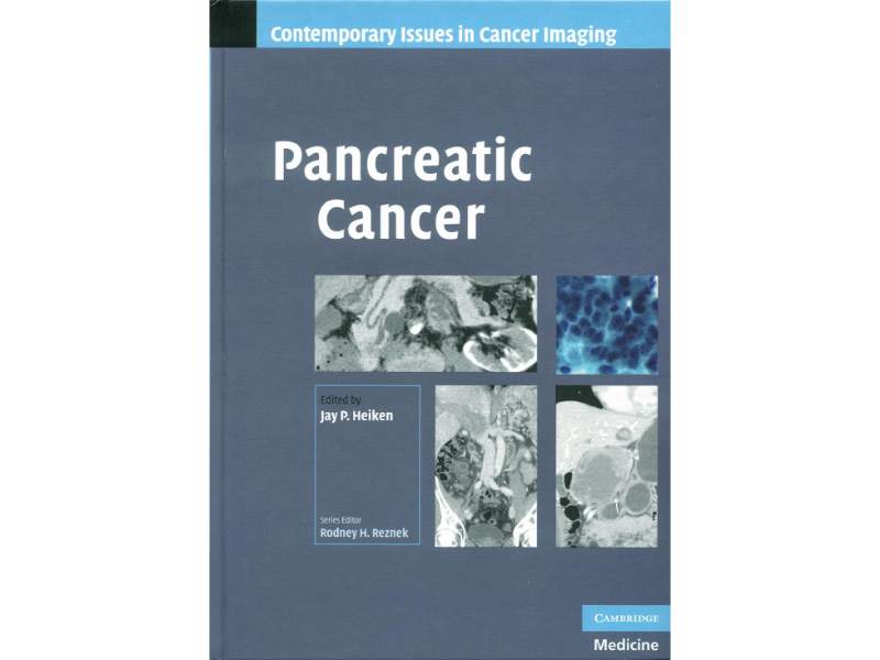 Cáncer de Páncreas / Pancreatic Cancer (Contemporary Issues in Cancer ...