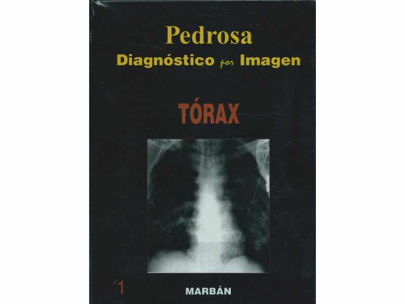 Diagnóstico por Imagen, Vol. 1: Tórax