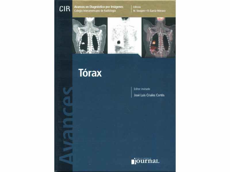 Avances en Diagnóstico por Imágenes 2: Tórax (CIR, Colegio ...