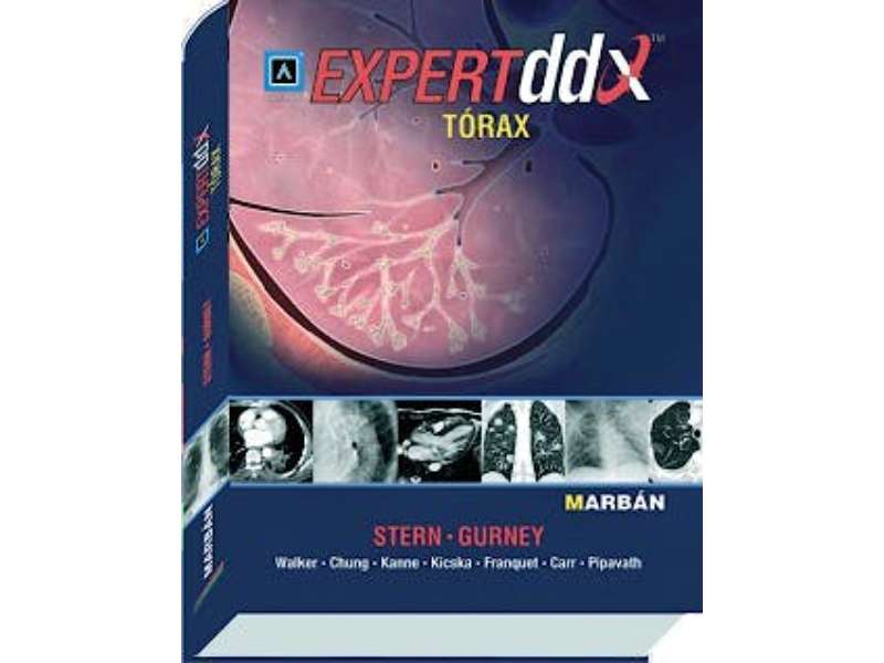 Expert DDX: Tórax