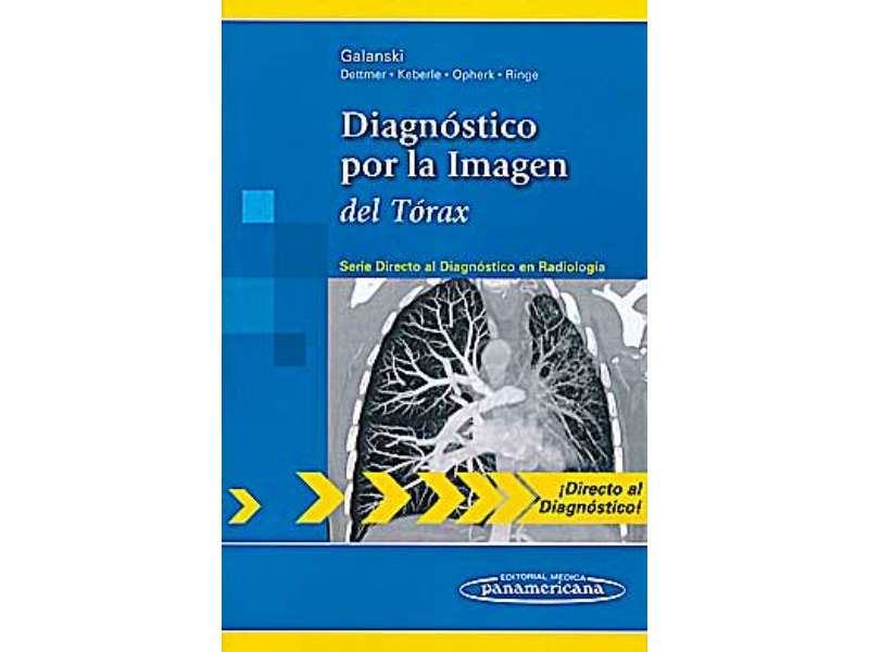 Diagnóstico por la Imagen del Tórax (Directo al Diagnóstico en Radiología)