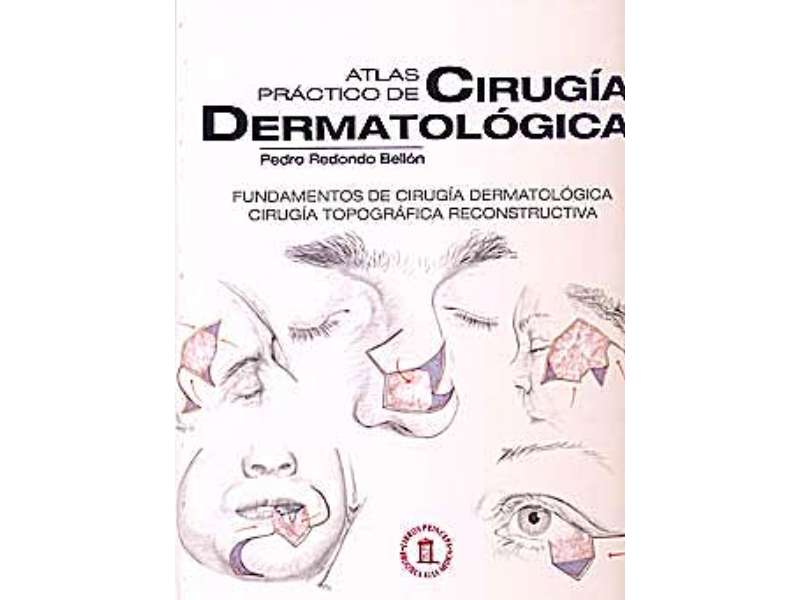 Atlas Práctico de Cirugía Dermatológica. Fundamentos de Cirugía Dermatologíca. Cirugía ...