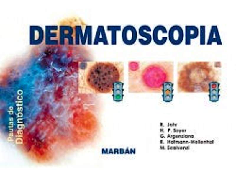 Dermatoscopia. Pautas de Diagnóstico