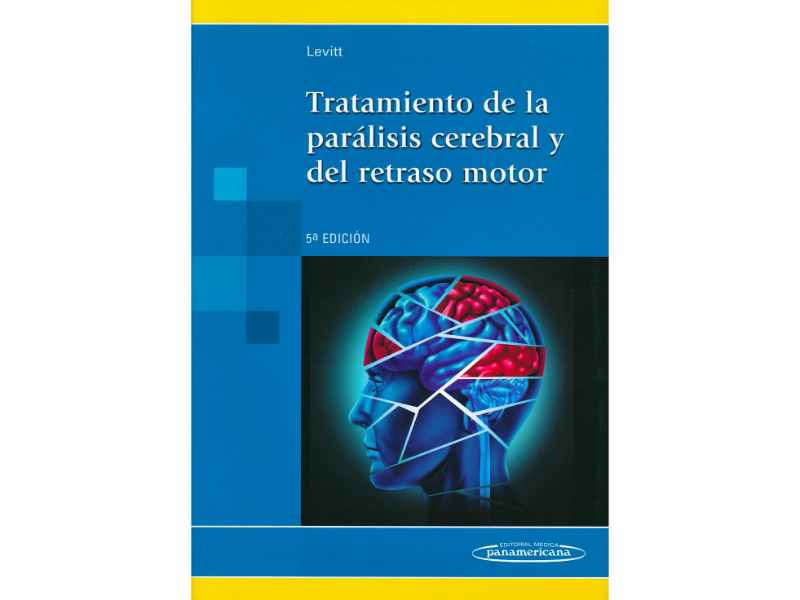 Tratamiento de la Parálisis Cerebral y del Retraso Motor